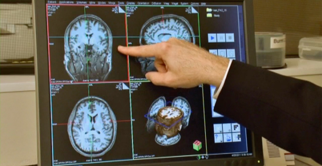 Tools of Neuroscience: MRI/fMRI - Annenberg Learner